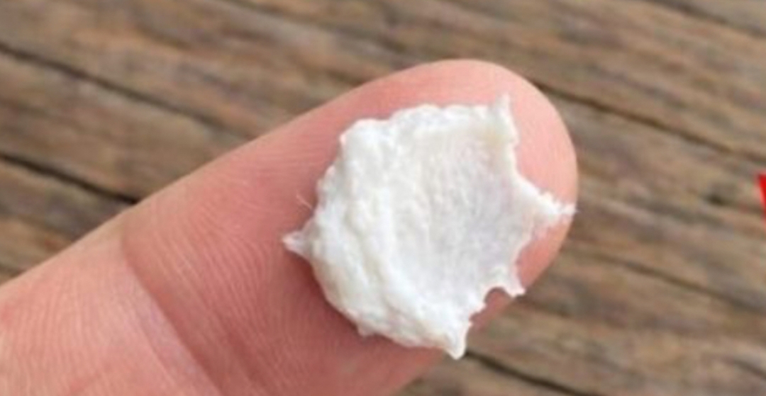 5 Simple Natural Home Remedies to Help Prevent Cavities and Support ...